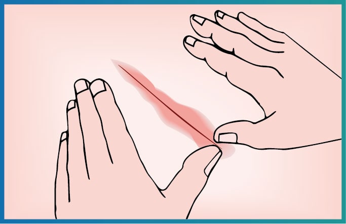 Everything you need to know about surgical glue - PerfectSeal